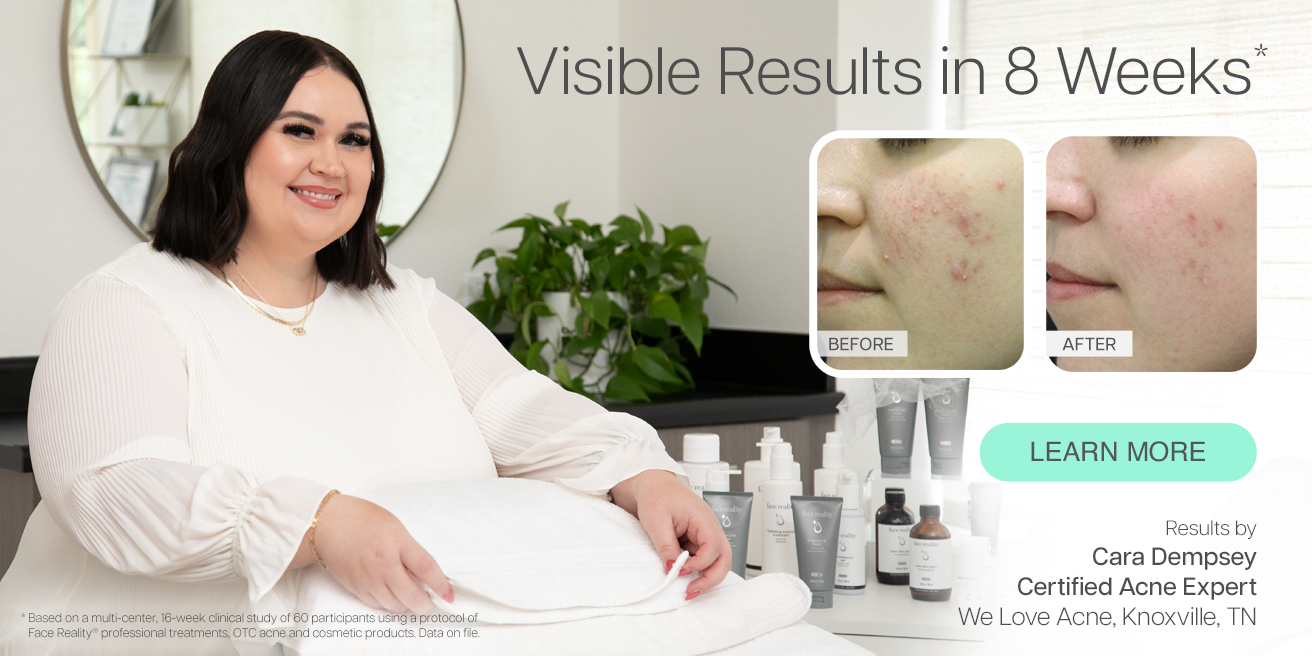 Face Reality Skincare | Professional Acne Treatment for Clear Skin